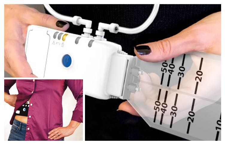 SES Force-4 | Somavac Post Surgical Vacuum Design